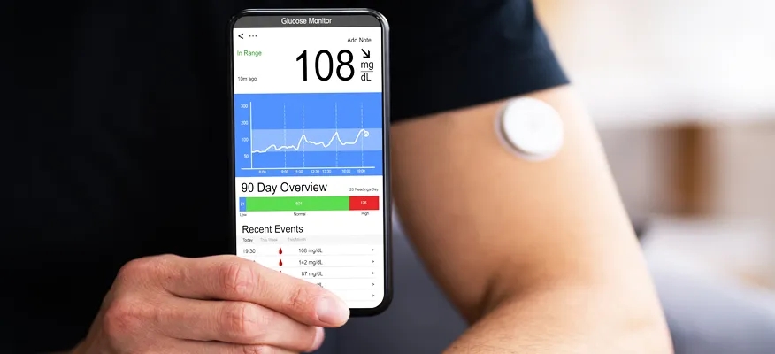 Guide to CGM-Continuous Glucose Monitoring