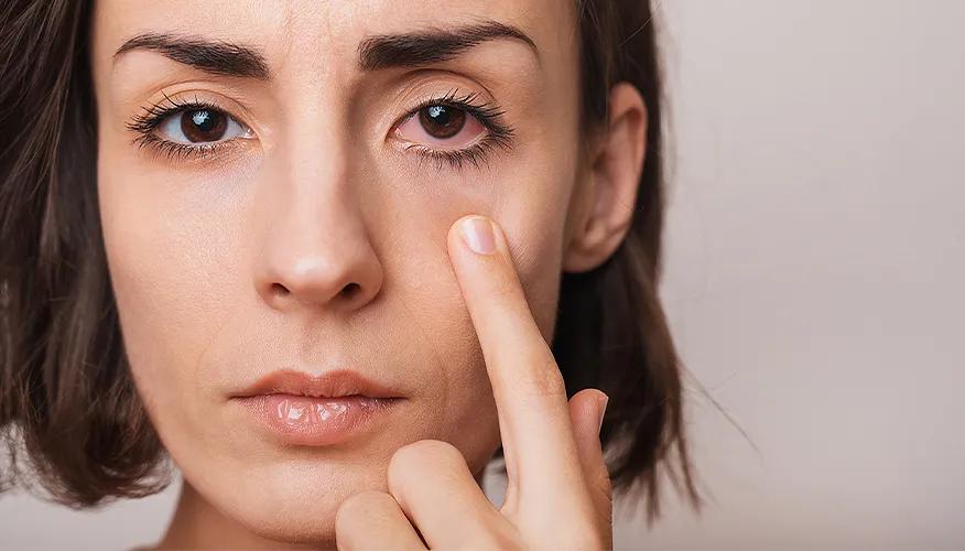 Understanding Sore Eyes: Causes, Symptoms and Treatment Options