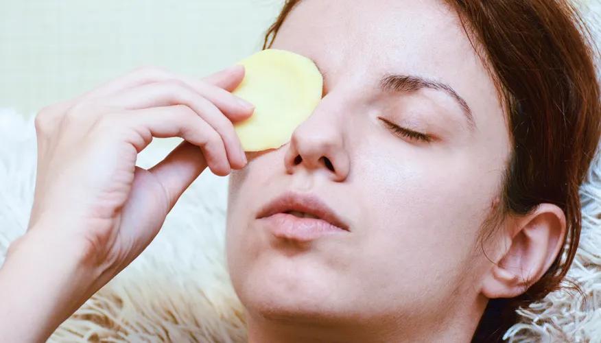 Top 9 Benefits of Potato for Face You Should Know